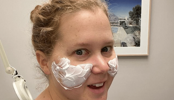 Amy Schumer laat fillers verwijderen - Weekend Online